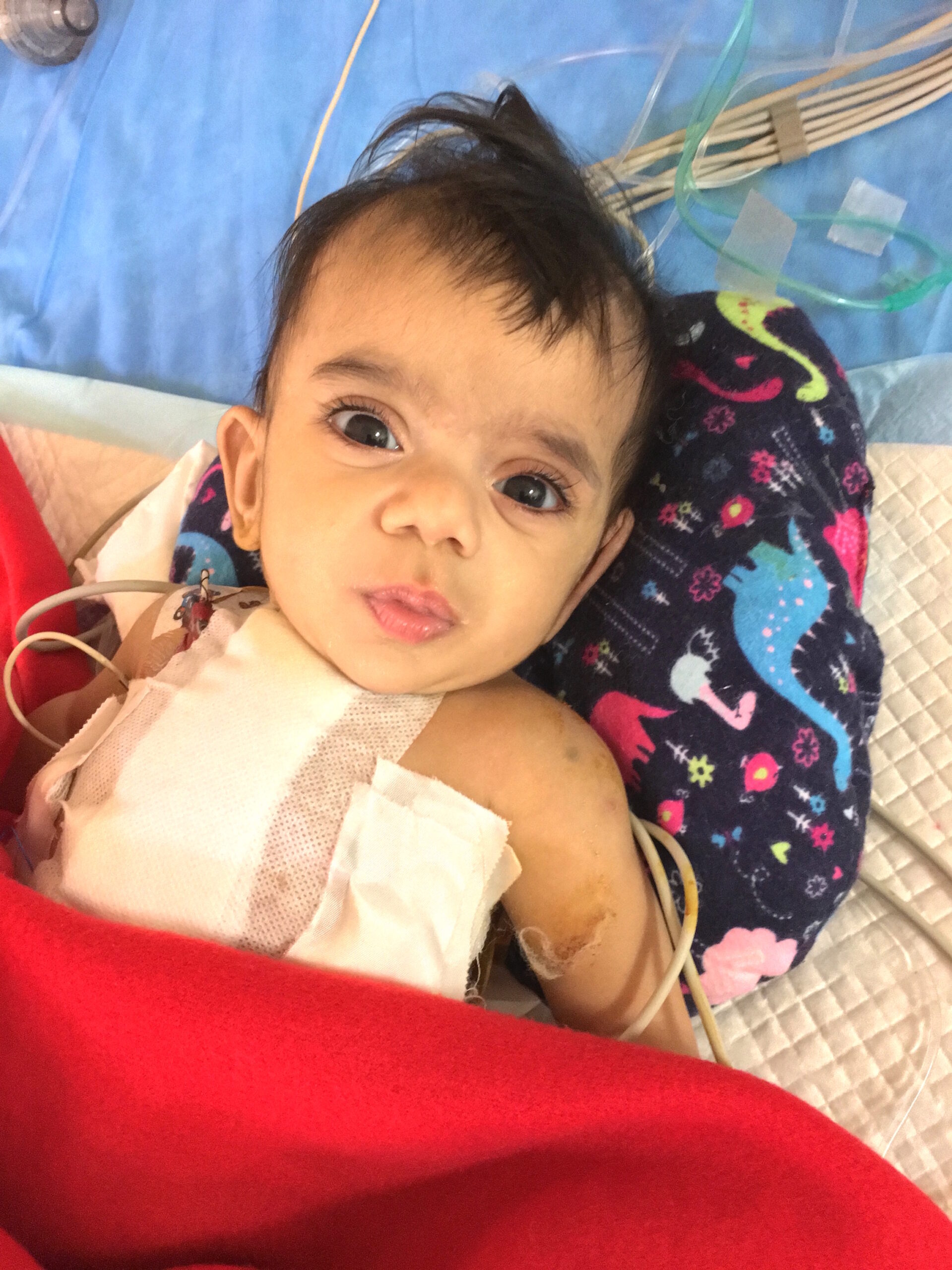 Meet Narjis, Our First Patient Of 2017! – Global Cardiac Alliance